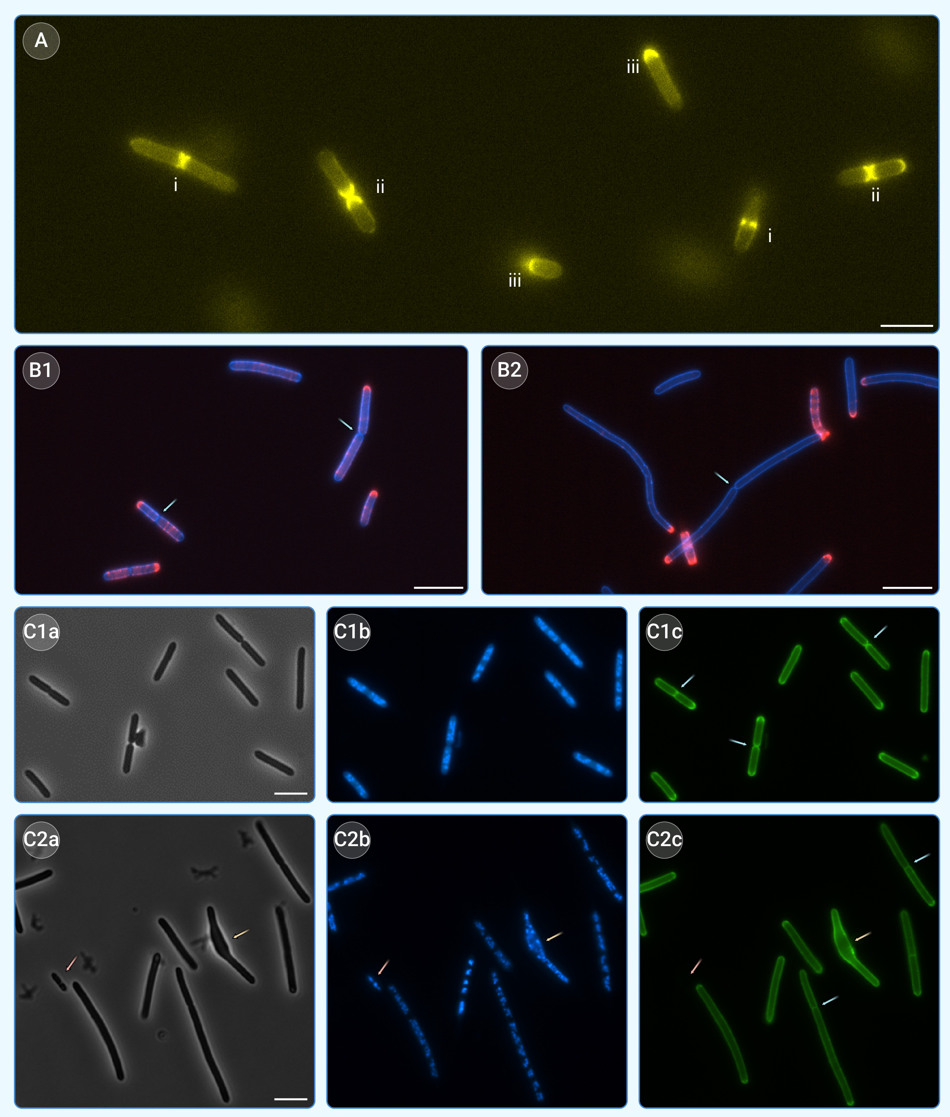 Illuminating a bacterial adaptation mechanism: Infrared-driven cell ...