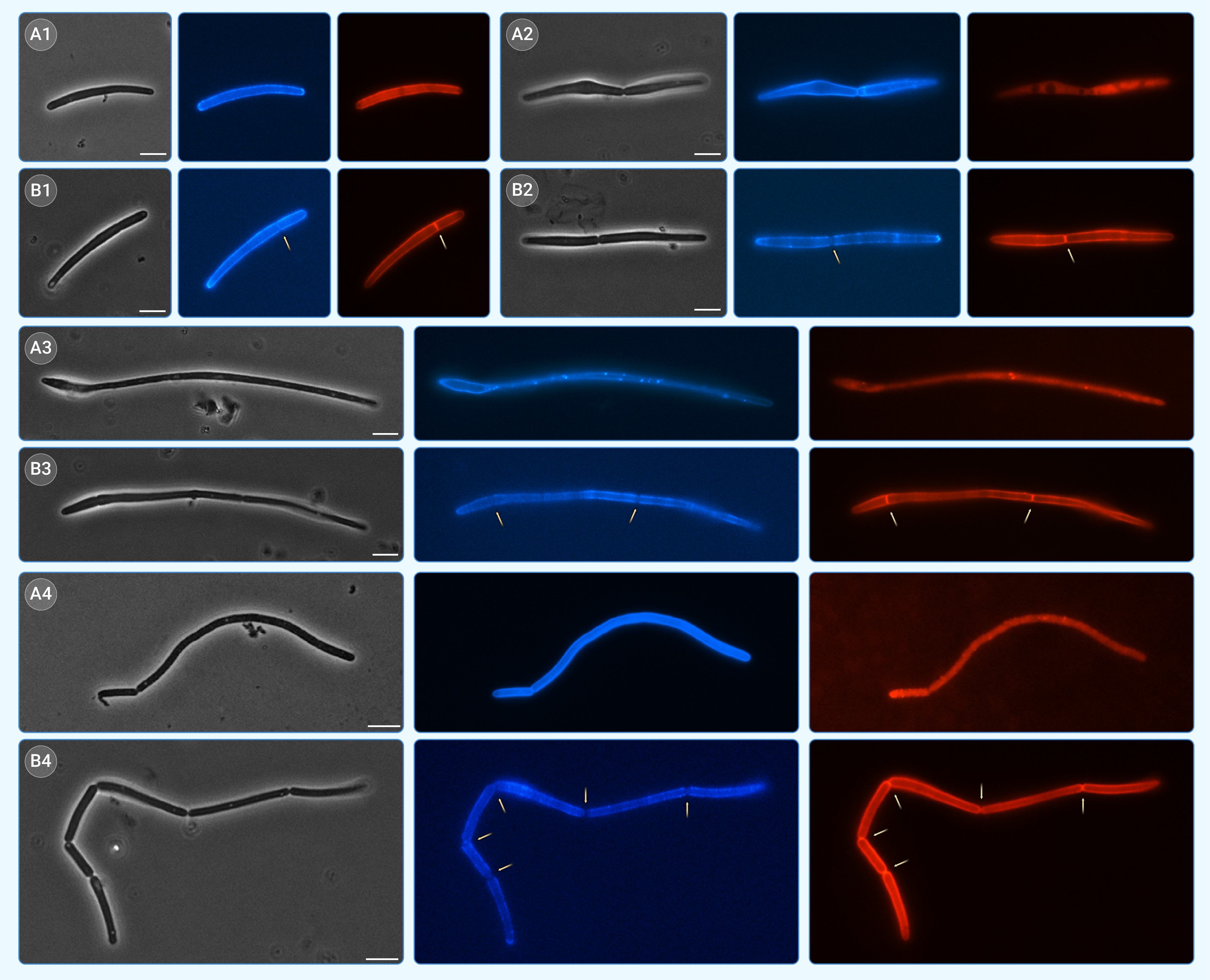 Illuminating a bacterial adaptation mechanism: Infrared-driven cell ...