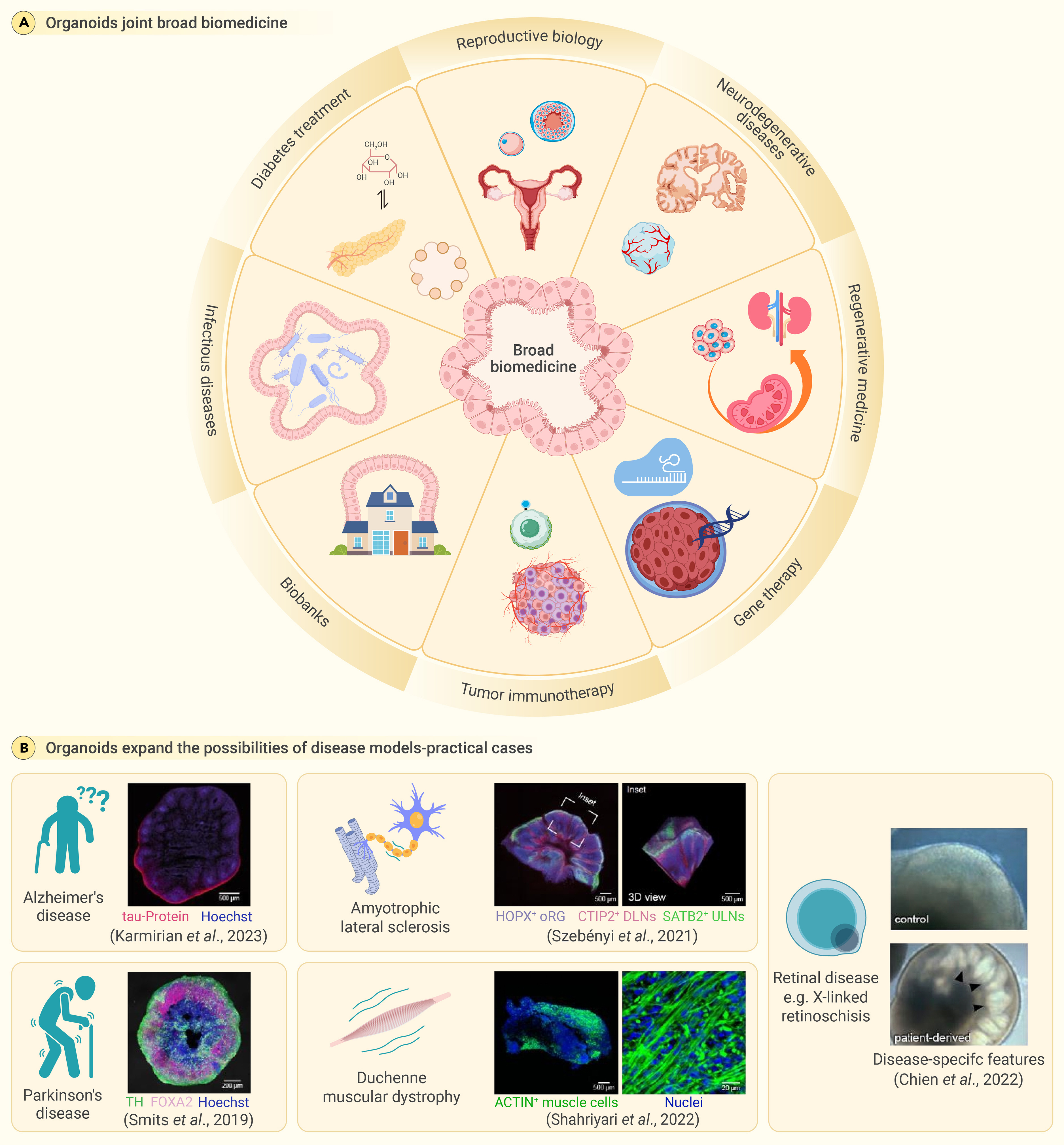 Landscape of human organoids: Ideal model in clinics and research