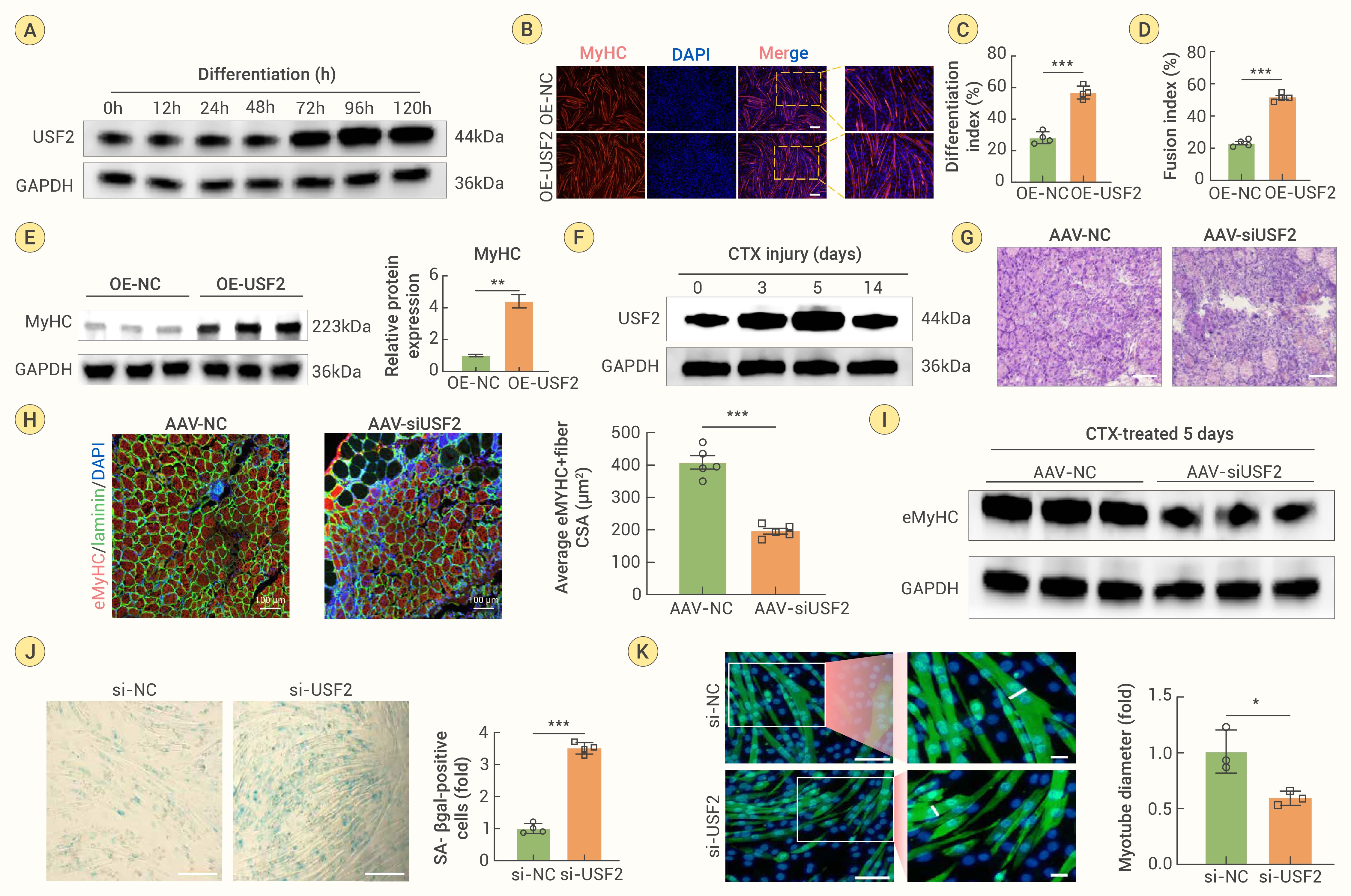Single-cell analysis reveals conserved regulons shaping muscle stem ...