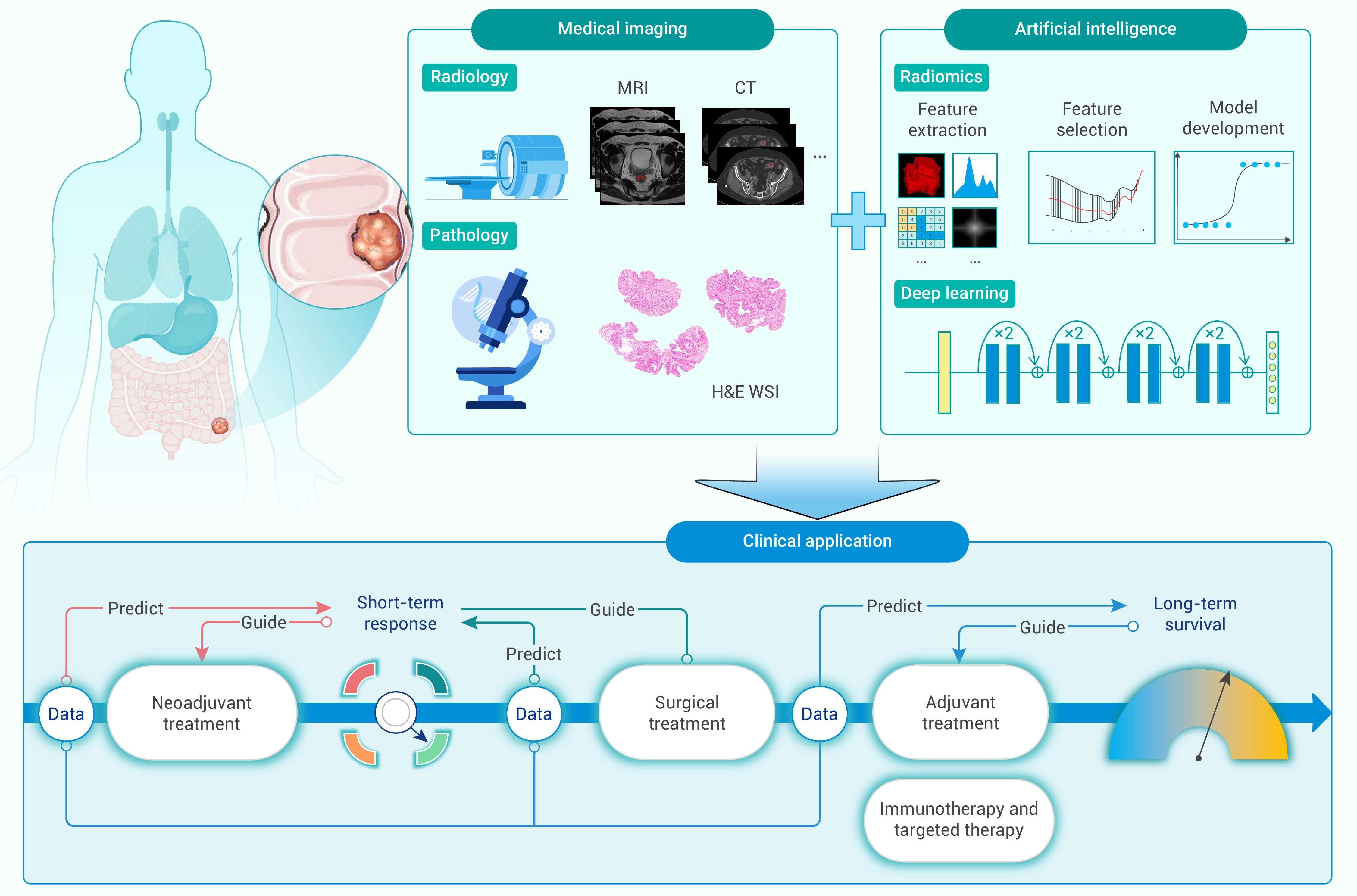 Improving prediction of treatment response and prognosis in colorectal ...