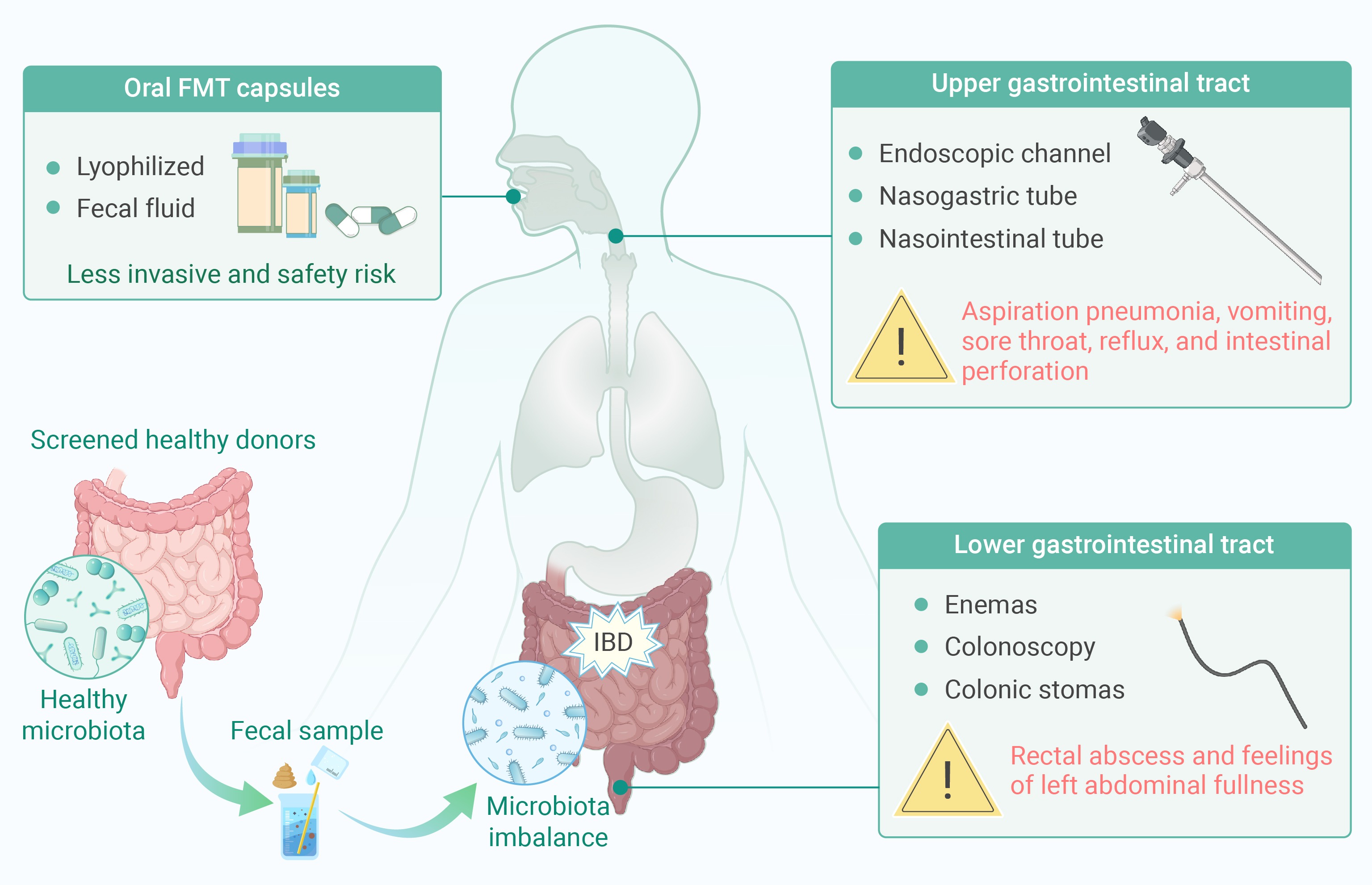 Intestinal microecology dysbiosis in inflammatory bowel disease ...