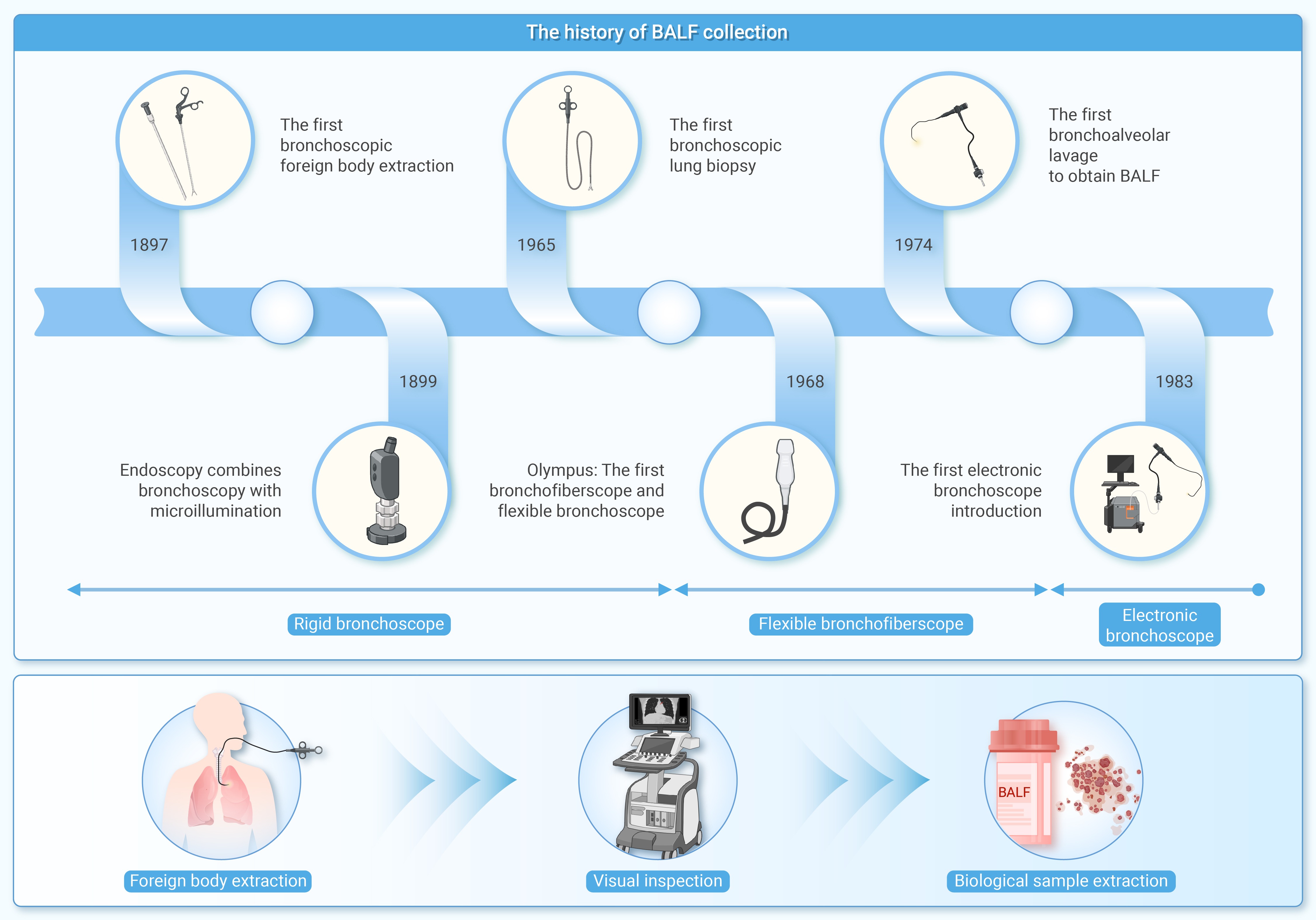Bronchoalveolar lavage fluid (BALF): Clinical applications for present ...