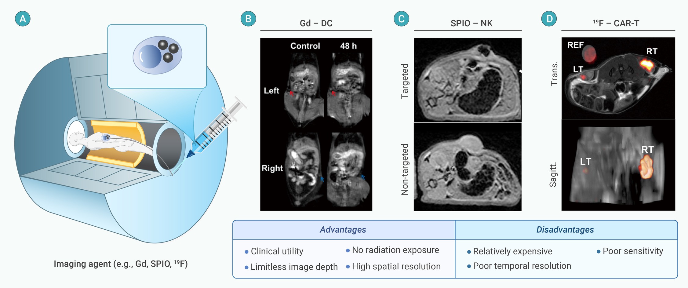 Application of non-invasive imaging on cell tracking of adoptive cell ...